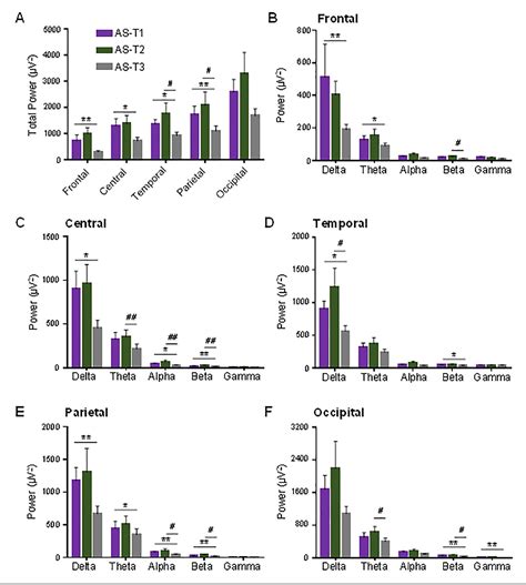 Figure 1 From Quantitative Eeg Analysis In Angelman Syndrome Candidate