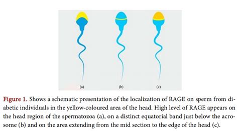 Effects Of Diabetes Mellitus Upon Sperm Quality Insight Into Molecular Level