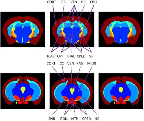 figure 3 from automated segmentation of mouse brain images using