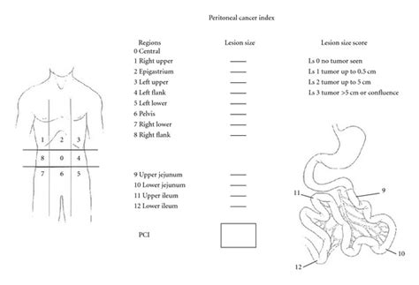 The Peritoneal Cancer Index Pci This Index Combines Size And