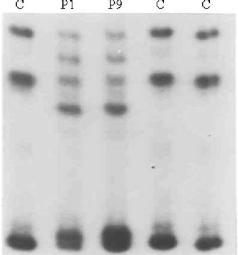 Figure 1 From A Heterozygous Mutation In The Desert Hedgehog Gene In