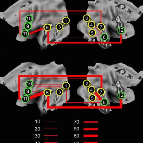Developmental Increases In Functional Connectivity Between Visits 1 And Download Scientific