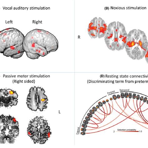 Functional Mri Applied To The Neonatal Brain In Both Task Based And Download Scientific Diagram