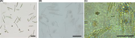 Isolation Of Adult Mouse Cardiomyocytes Using The Langendorff Device