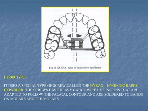 Expansion In Orthodontics Ppt