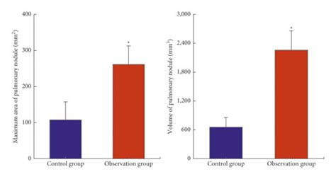 Comparison Of The Maximum Area And Volume Of The Pulmonary Nodule