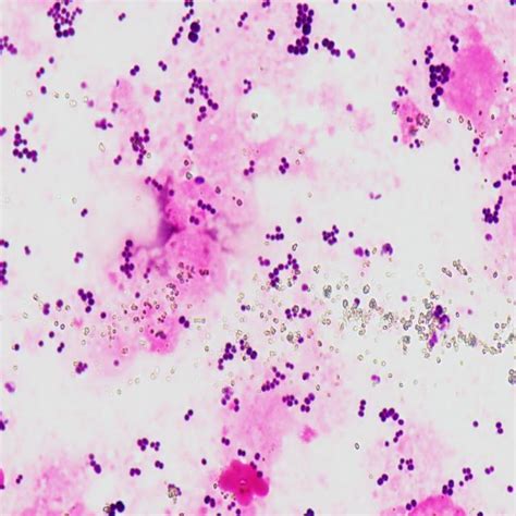 Staphylococcus Object Detection Dataset By Sugimoto