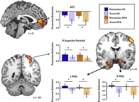 Accuracy Independent Recollection Activity Brain Regions Exhibiting Download Scientific