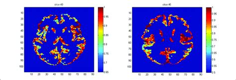 The Average Prediction Map Based On The Voxel Level Prediction Download Scientific Diagram