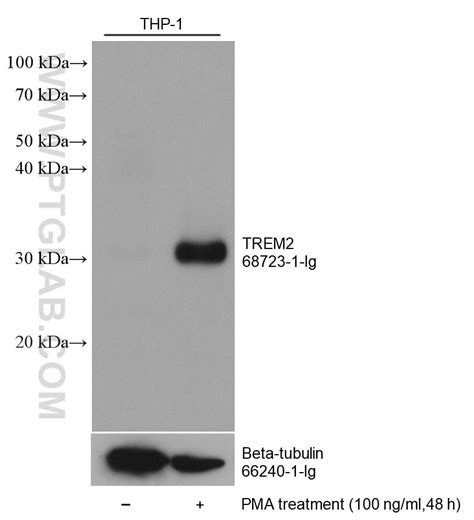 Trem2 Antibody 68723 1 Ig Proteintech