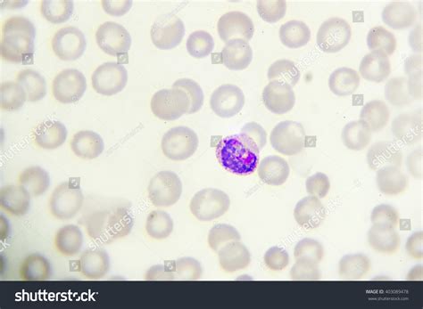 371 Malaria Schizont 图片、库存照片和矢量图 Shutterstock