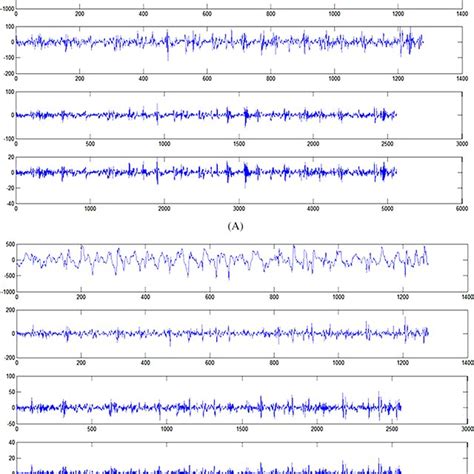 Level 3 Decomposition Of Electroencephalogram Eeg Signal A Wavelet