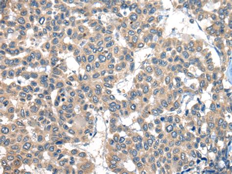 兔抗pdk1多克隆抗体anti Pdk1 Rabbit Polyclonal Antibody 生命科学产品与技术服务 生工生物工程上海