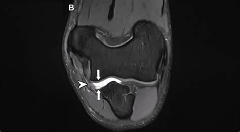 Fever View Mri Dr Christopher Ahmad