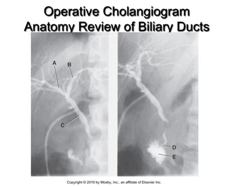 Operative Cholangiogram Anatomy — Printable Worksheet