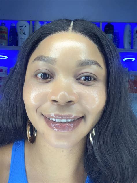 Chioma Sophia What Is Hydroquinone Hydroquinone Is A Skin Lightening Agent It Bleaches The