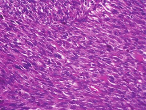 Uniform Spindle Shaped Cells With Quit Undefined Cell Borders Download Scientific Diagram