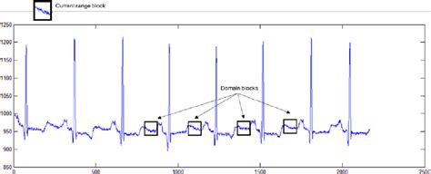 Figure 1 From A Fast Fractal Model Based Ecg Compression Technique