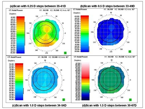 Corneal Topography Eyewiki