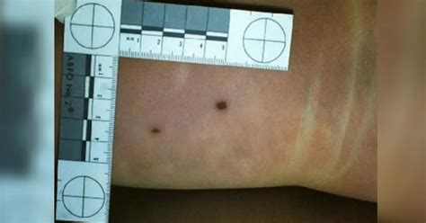 Horrific Jonbenét Ramsey Crime Scene Gallery