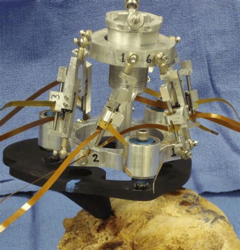 Prototype Of A PCI Robot With Its Fixed Frame Black Part Mounted On A Download Scientific