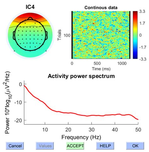 Github Anne Andreseneeg Processing Eeg Data Collection And Processing In Matlab Proposed