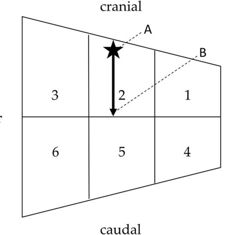 Schematic Drawing Of The Medial Wall Of The Maxillary Sinus Used For