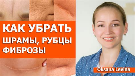 Как убрать рубцы и шрамы на коже Шрамы после прыщей рубцы на теле и