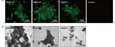 Isolation Of The Three New Sftsv Strains In Cell Culture A Detection