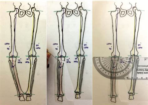 Scielo Brasil Use Of The Bone Ninja Mobile Application As A Pre
