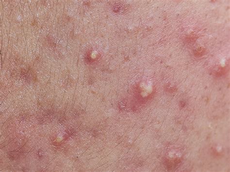 오체안피부과의원 수원