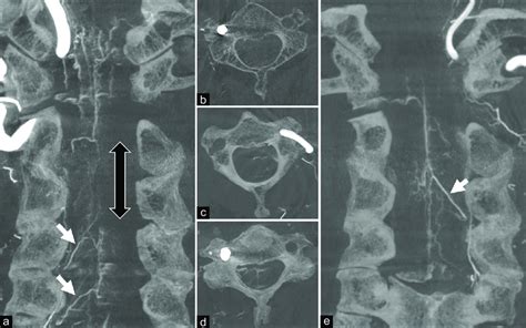 Reconstructed Cone Beam Computed Tomography Cbct Scans Obtained 4 Download Scientific Diagram