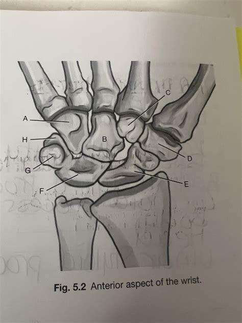 Carpal Bones Diagram Quizlet