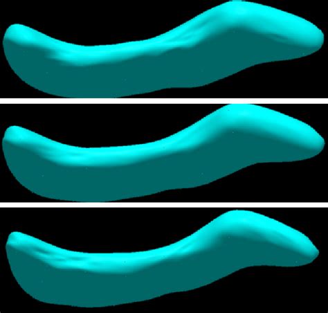 Figure 6 2 From Classification Of Neuroanatomical Structures Based On Non Euclidean Geometric