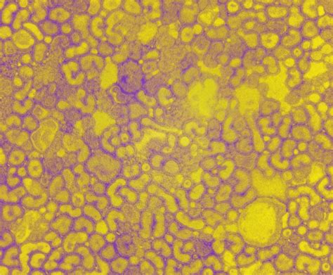 Influenza A Doccheck