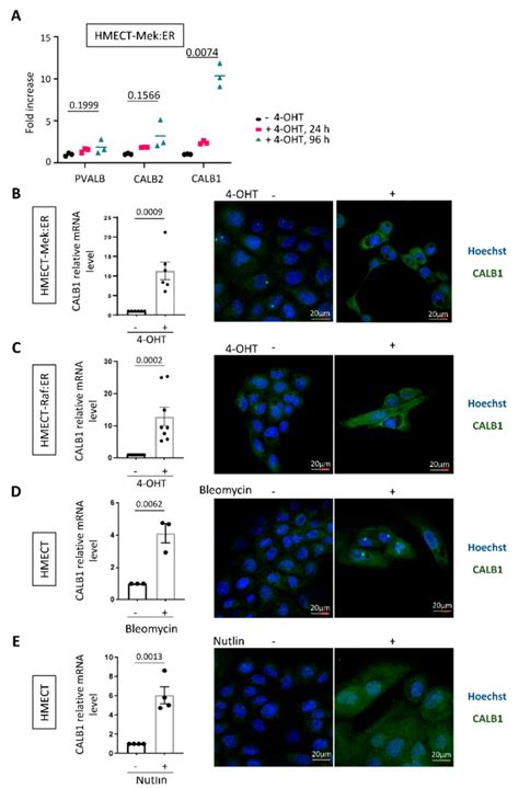 Expression Of The Calcium Binding Protein Calb1 Is Induced And Controls Intracellular Ca2