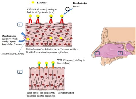 Staphylococcus Aureus Infection In Nose