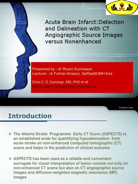 Pdf Acute Brain Infarctdetection And Delineation With Ct Angiographic Source Images Versus