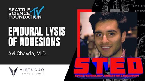 Epidural Lysis Of Adhesions Avi Chavda Md Youtube