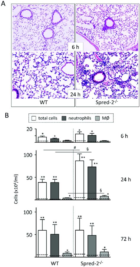 Lps Induced Lung Inflammation Mice Were Injected Intratracheally With Download Scientific