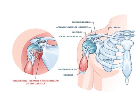 Acromion Process