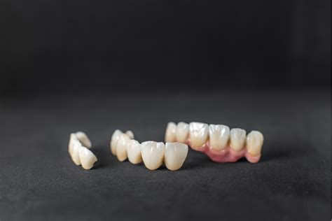 Choosing The Right Dental Crowns For Your Smile