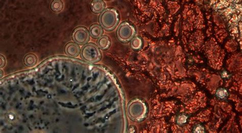 Blood Coagulation A List Of Blood Clotting Factors Their Significance
