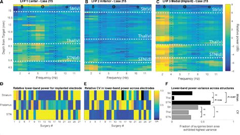 Spectrogram Of Recording Depth Over Frequency For The Delta Theta
