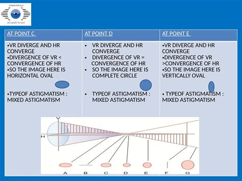 Astigmatism Pptx Pptx