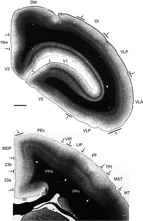 Myeloarchitectural Characteristics Of Cortical Areas Of The Marmoset Download Scientific