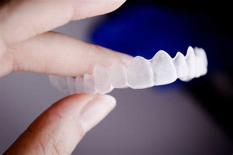 Clear Aligner Orthodontics A Clear Choice For Straightening Teeth For