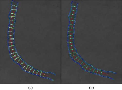 extracting vessel diameters in epmt download scientific diagram