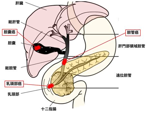 胆道領域 ｜ 診療案内 ｜ 福島県立医科大学 肝胆膵・移植外科学講座