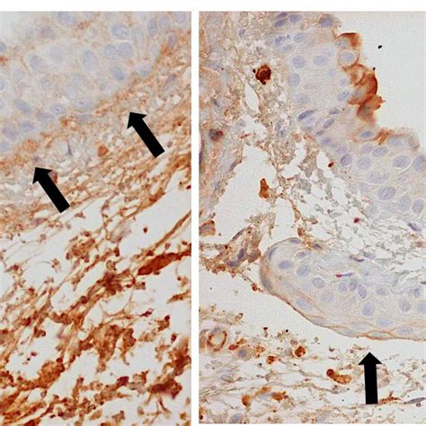 Pdf The Value Of Conjunctival Immunohistochemistry Analysis For The
